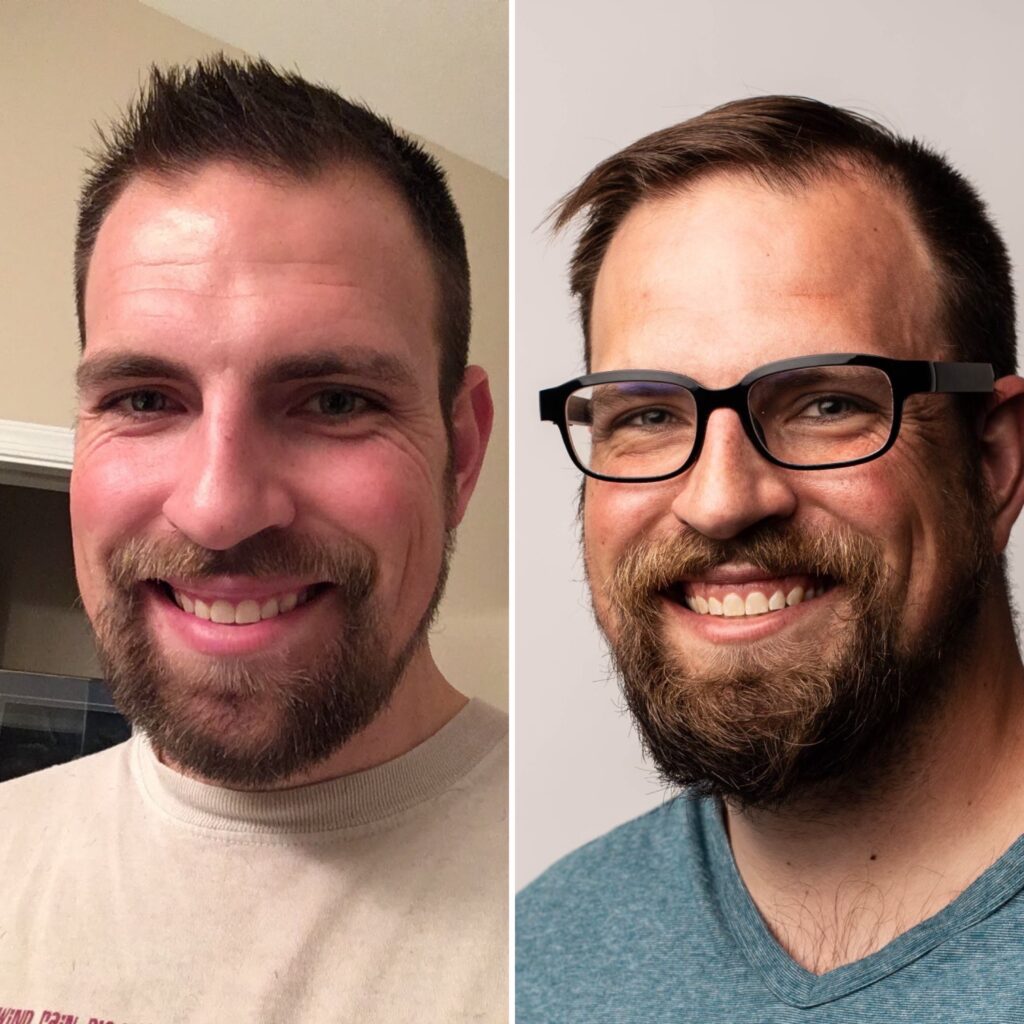 Tapering Off Antidepressants: My Experience | A Ballsy Sense of Tumor